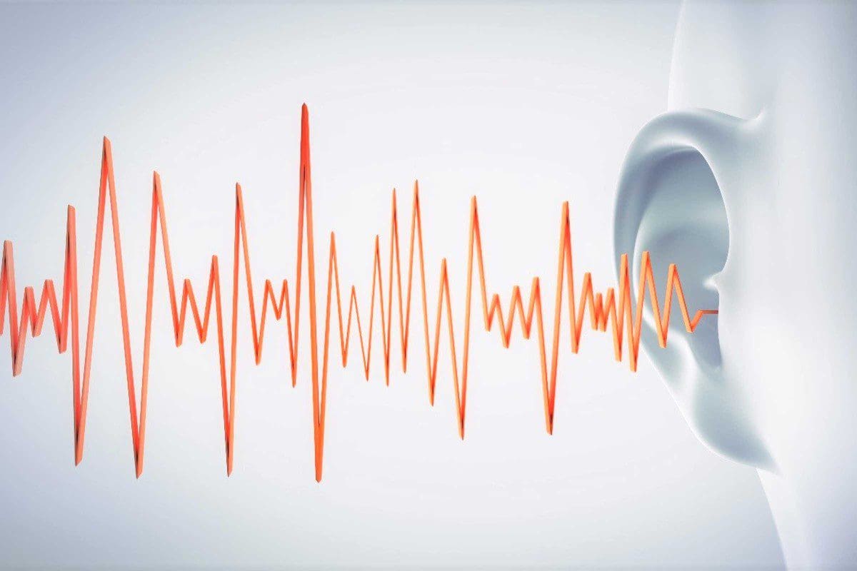 What Are Acoustics | Мusic Gateway